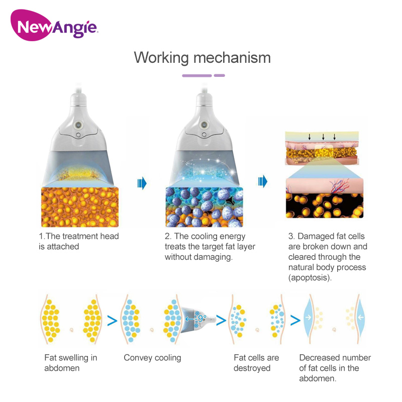 Newangie® Latest Silicone Cryo Machine - ETG50-9S